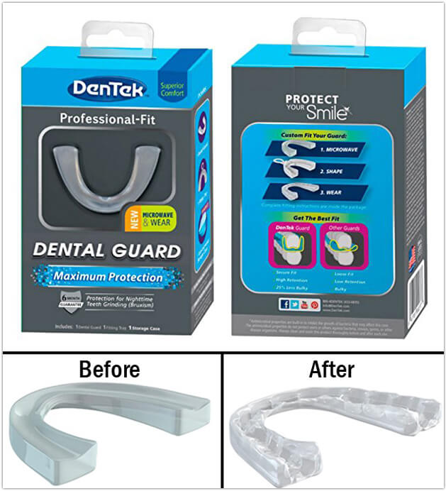 Top10 beste bitjes tegen tandenknarsen!